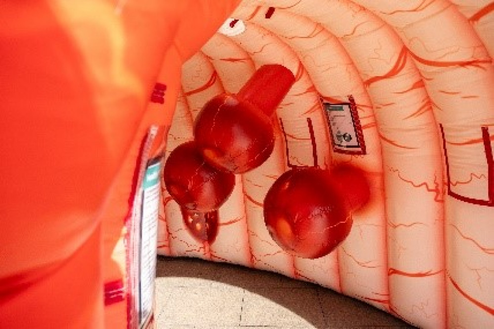Giant inflatable will be visiting Thurrock to raise awareness of bowel ...
